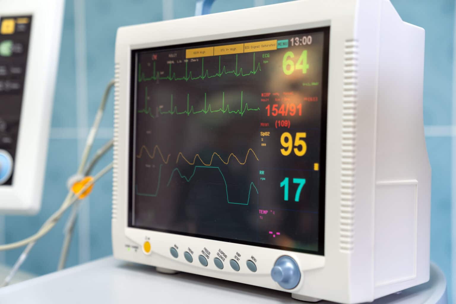 What does an EKG Technician Do? | Top 10 Duties & Skills [2023 Updated]